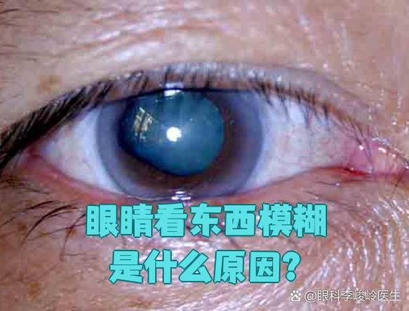 视力模糊不清图标