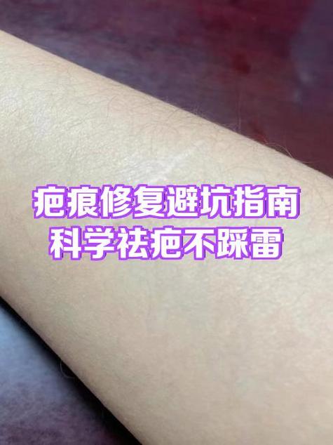 凹的疤痕怎么修复图标