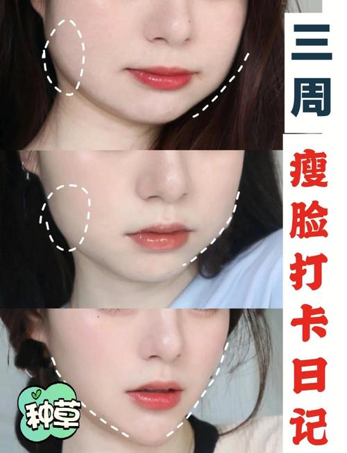 脸瘦怎么让脸饱满缩略图