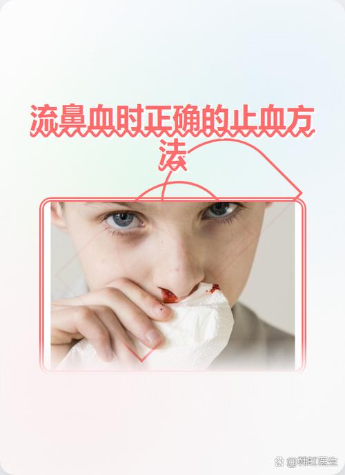 流鼻血吃糖有用吗图标
