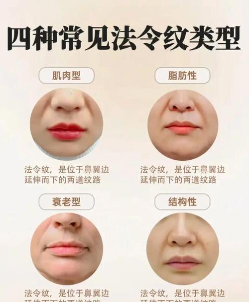 网上卖的消除法令纹产品有用吗图标