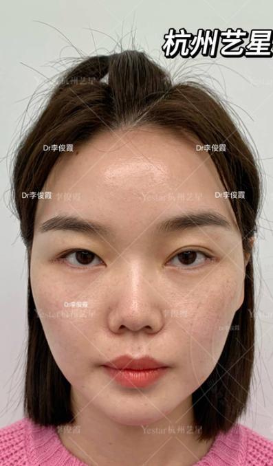 怎么变成娃娃脸图标