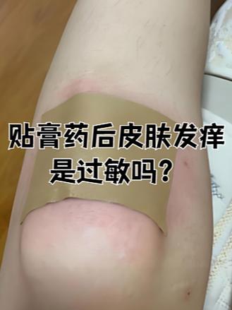 膏药粘不住老掉怎么办图标