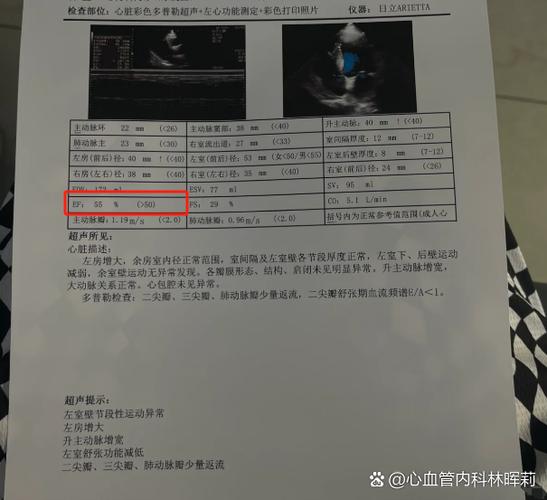 心脏EF和FS正常值图标