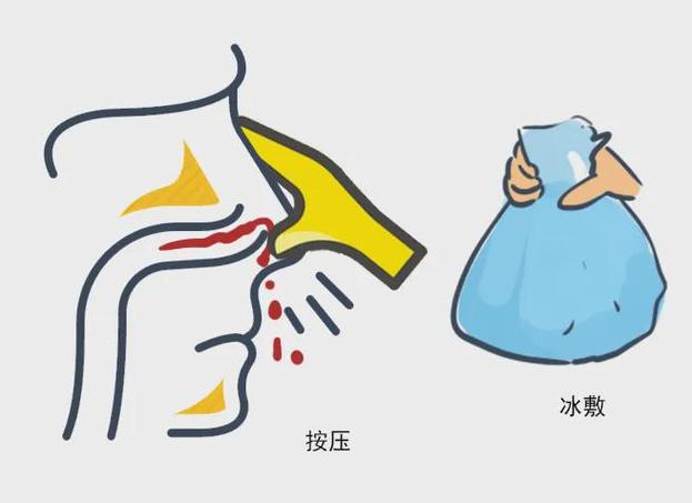 流鼻血的土方法治疗图标