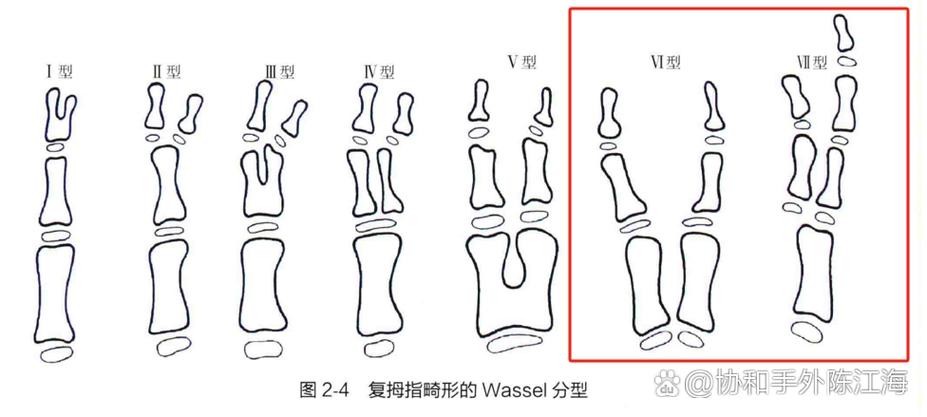 多指是什么图标