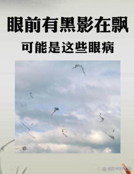 眼睛前老是有黑影飘动图标