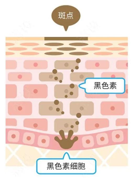 黑色素怎么快速排出来图标