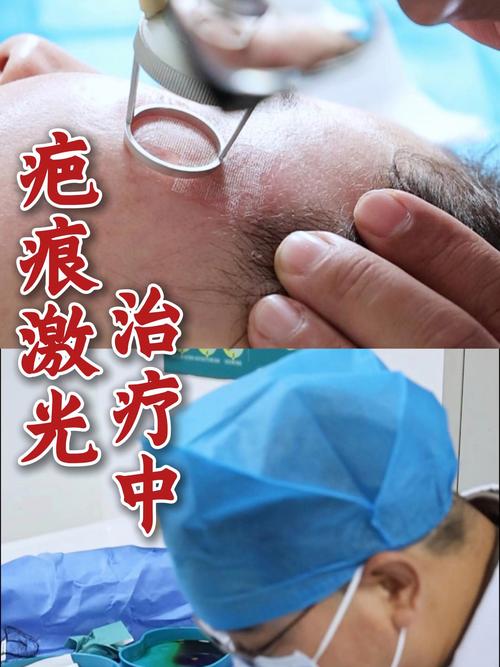 特效治疗疤痕截图