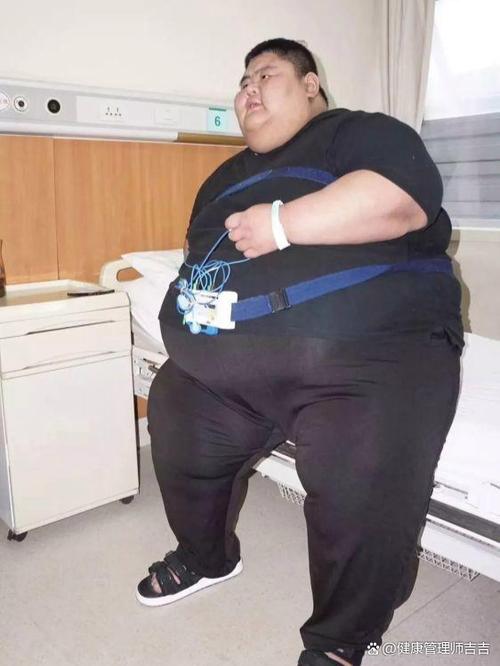 突然发胖的原因是什么图标