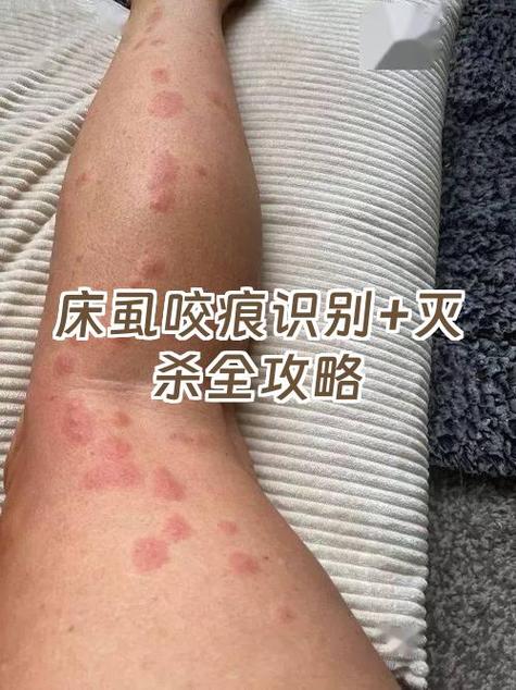 华为没有了擦除联系人痕迹图标