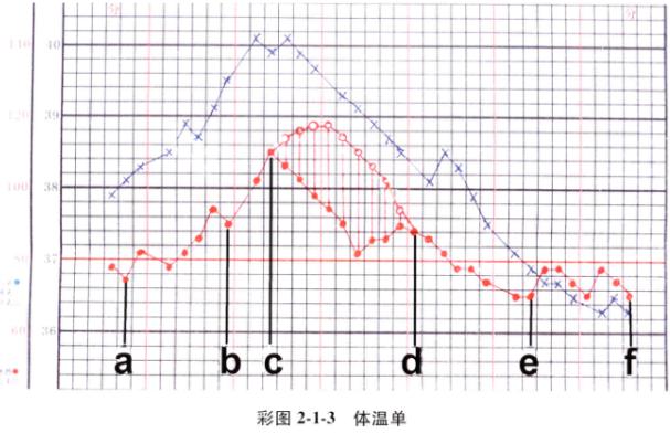 绌脉的表现