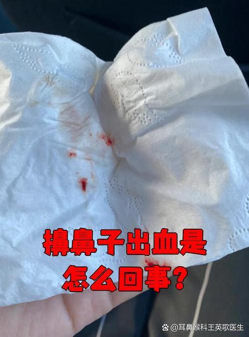 流鼻血颜色很淡怎么回事缩略图
