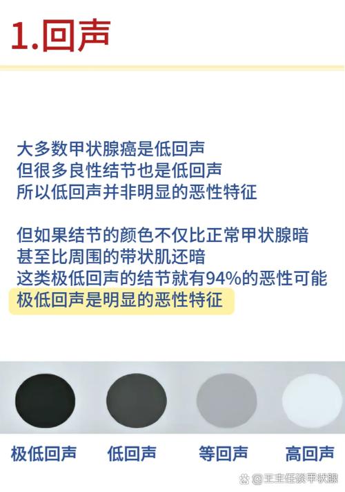 低回声区一定有问题吗图标