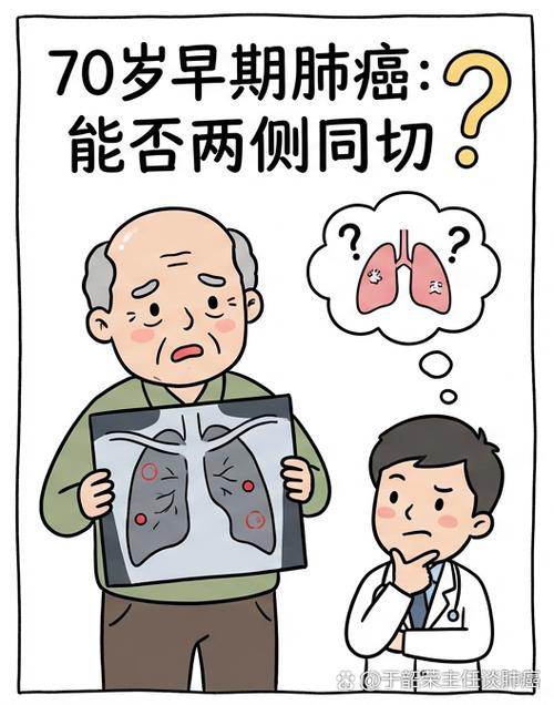 70岁肺癌有必要治疗吗图标
