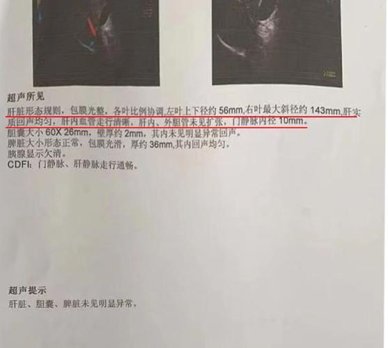 彩超影像报告单怎么看图标
