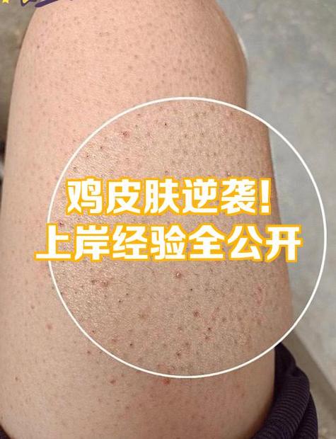 吃了鸡身上长红点怎么办图标