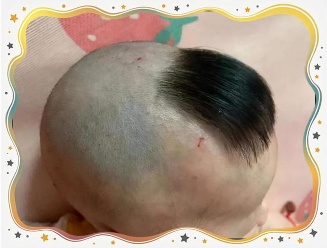 小孩剃满月头视频截图