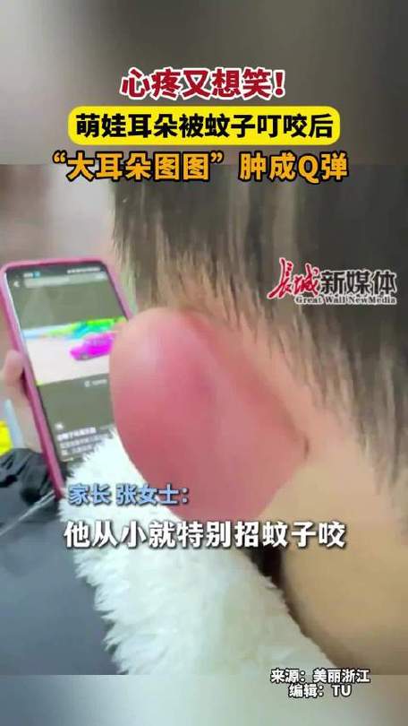 耳朵进蚊子图标