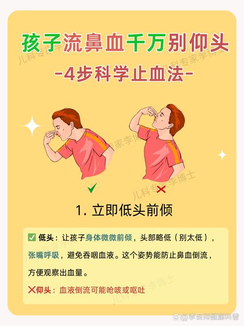 怎样才能快速流鼻血?图标