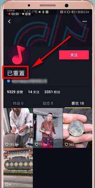 重置抖音账号图标