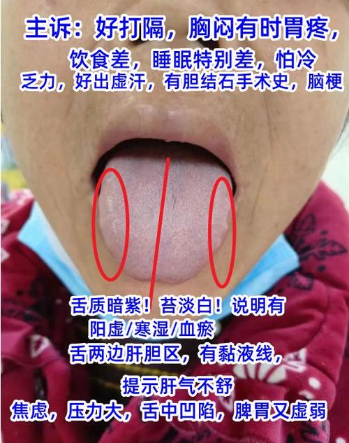 气虚可以自愈吗图标
