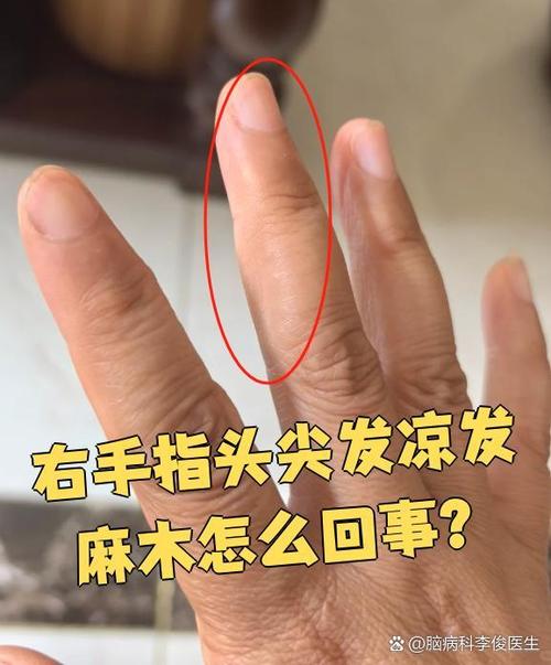 手指指尖发凉是什么问题截图