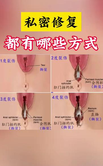 怎么让私密变回粉色图标