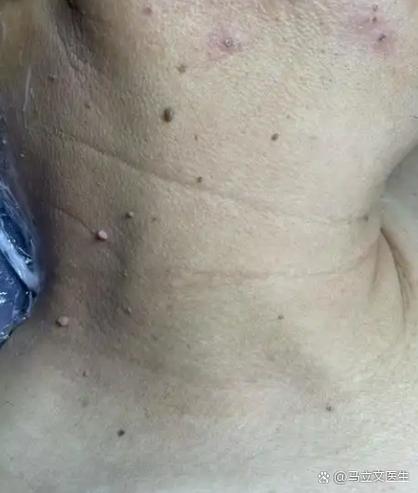 手臂里面摸到个圆球硬疙瘩图标