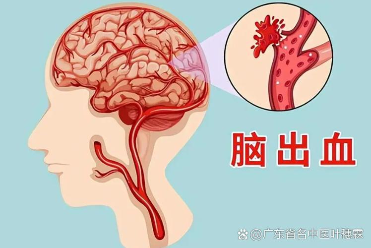 想事情感觉大脑像堵了一样截图