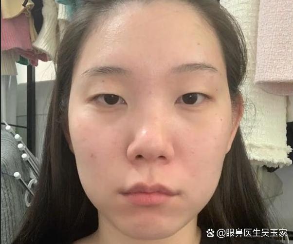 照片眼睛没睁开怎么修图图标