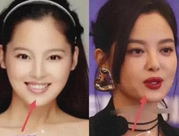 辛芷蕾的嘴唇叫什么唇图标
