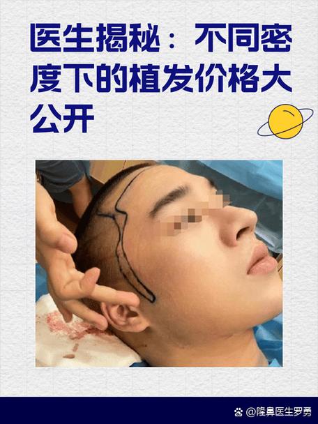 修头发多少钱一次截图