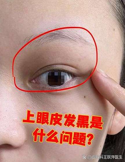 整个眼睛都是黑的图标