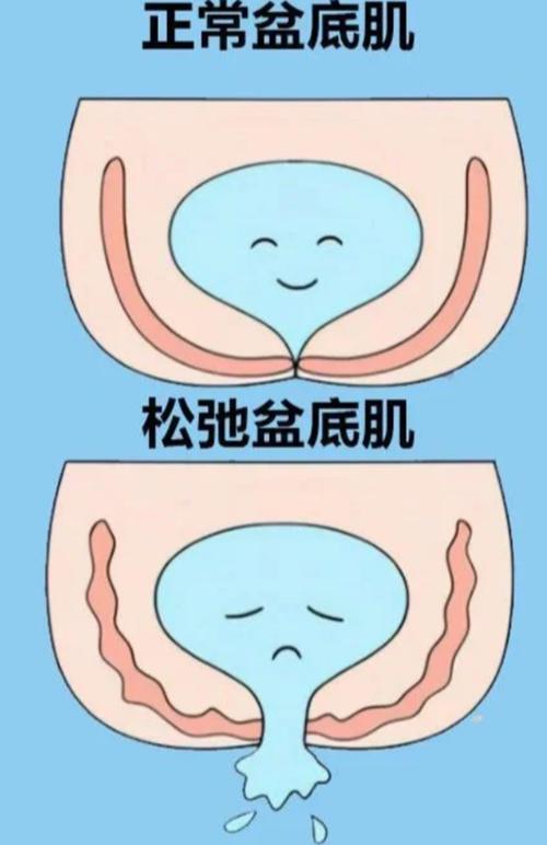 收紧盆底肌图标