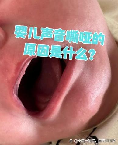广东人叫宝宝的意思是什么图标