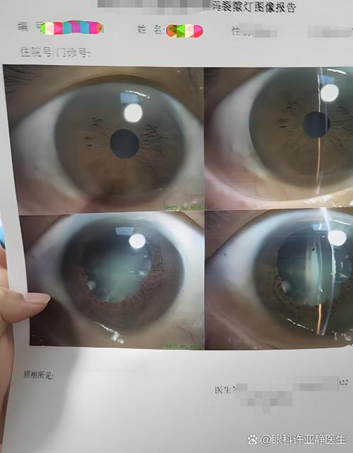 双眼看东西重影怎么回事图标