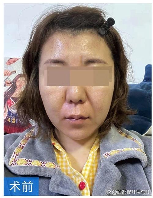 没有下颚线什么原因图标
