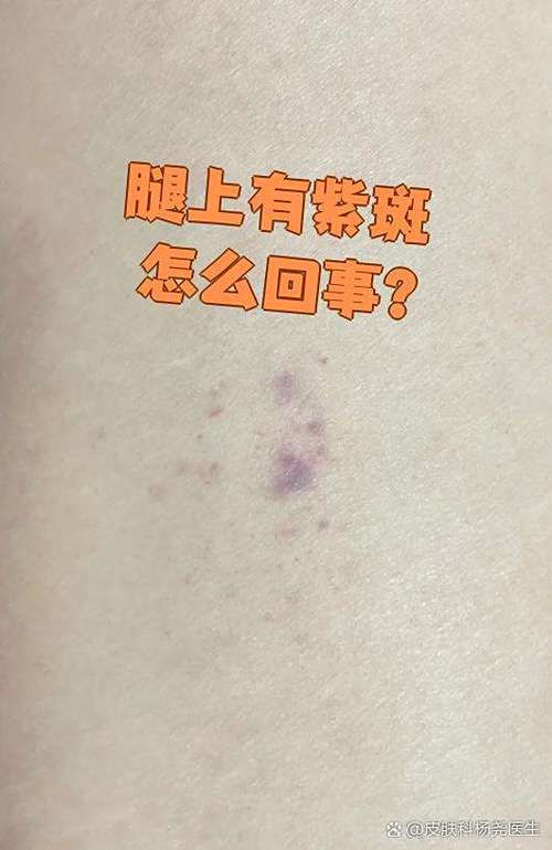 屏幕出现紫色的斑点图标