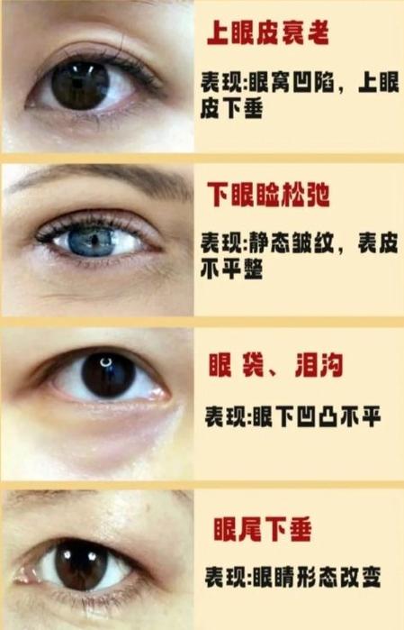上眼皮松弛的小偏方截图