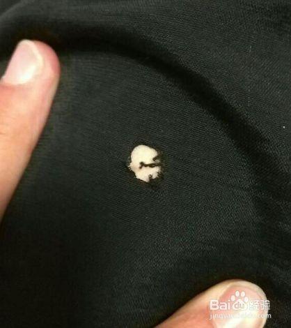 裤子烧个洞怎么补救图标