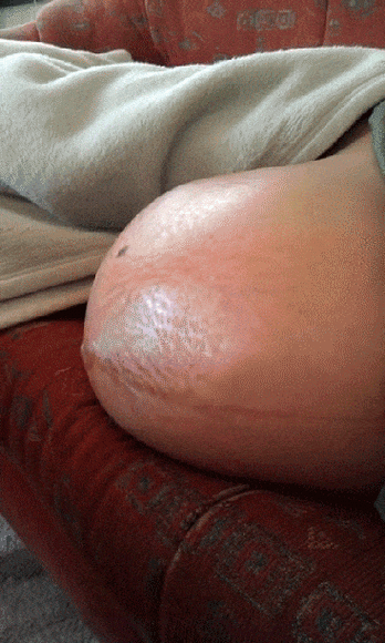 厚小花怀孕大肚子