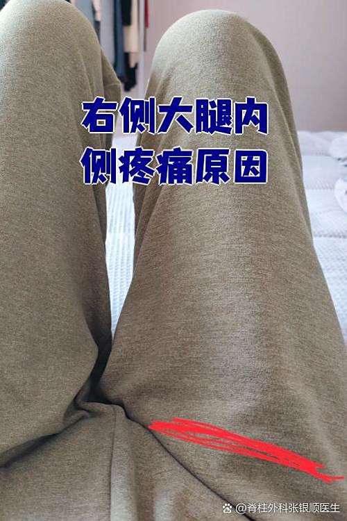 右大腿疼痛位置图图标