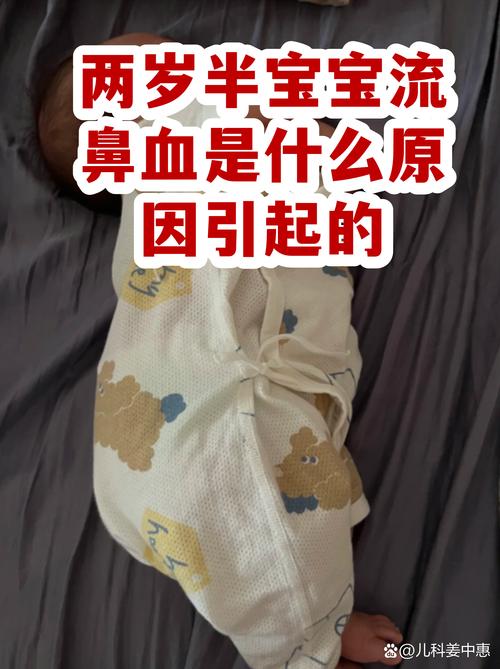 小孩睡着睡着突然流鼻血图标