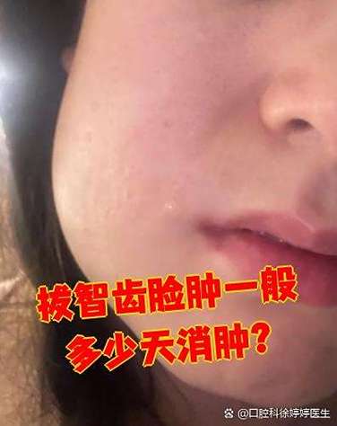 坏牙脸肿了一般几天恢复正常图标