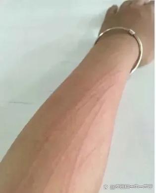 身上突然有划痕是什么原因图标