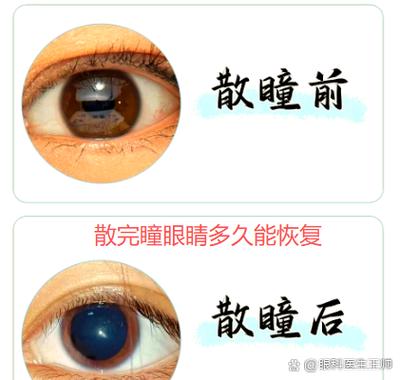 散完瞳眼睛多久能恢复图标