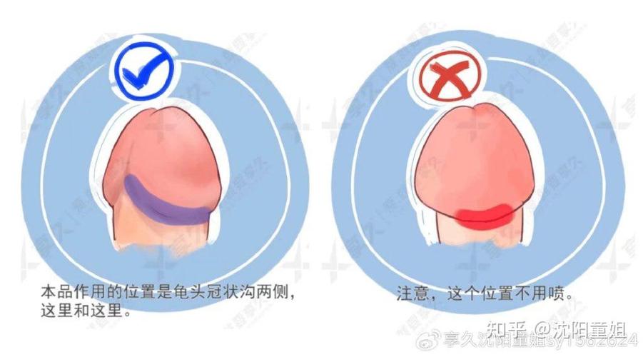 延时喷雾喷在哪个部位图
