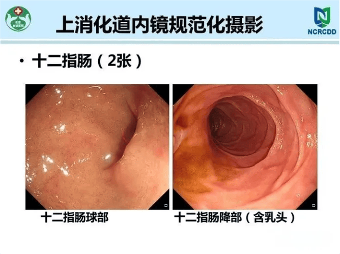 12指肠球部是指哪个部位图标