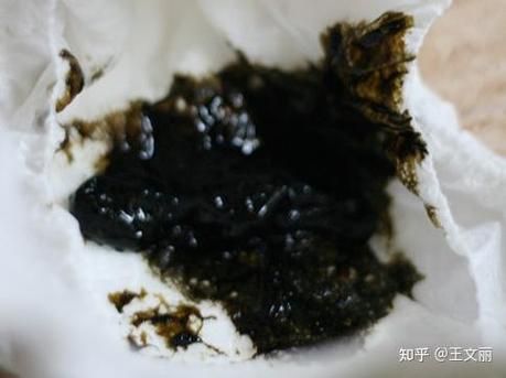流鼻血血是黑色的怎么回事游戏截图